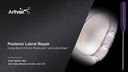 Arthrex - Posterior Labral Repair Using Short 2.9 mm PushLock® and ...