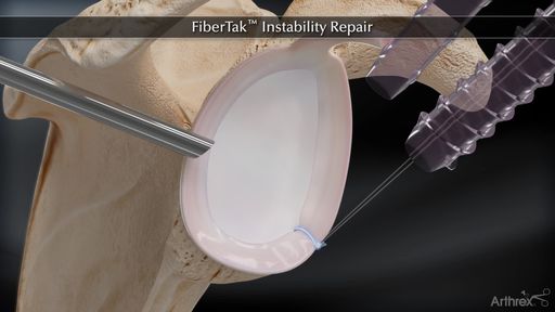 Arthrex - Helping Surgeons Treat Their Patients Better™