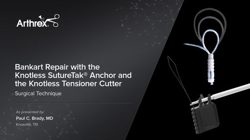 Arthrex - Helping Surgeons Treat Their Patients Better™