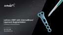 Arthrex - Lisfranc Plates
