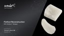 Arthrex - Flatfoot Reconstruction With AlloSync™ Wedges