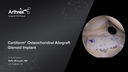 Arthrex - Cartiform® Viable Osteochondral Allograft