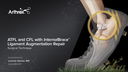 Arthrex - InternalBrace™ Ligament Augmentation Repair