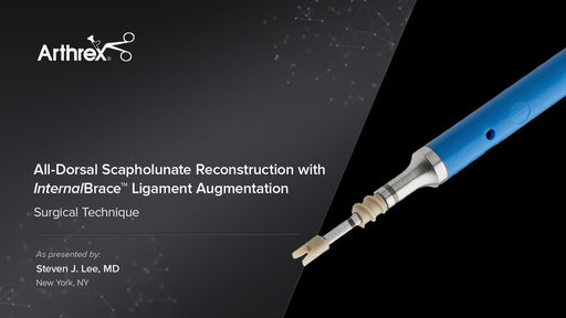 Arthrex - Helping Surgeons Treat Their Patients Better™