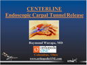 Arthrex - Centerline™ Endoscopic Carpal Tunnel Release Technique