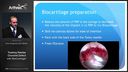 Arthrex - Treating Patellar Chondral Defect with BioCartilage®