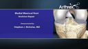 Arthrex - Meniscal Root Repair