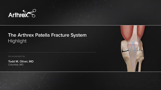 Arthrex - Helping Surgeons Treat Their Patients Better™