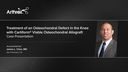 Arthrex - Treatment of an Osteochondral Defect in the Knee with ...