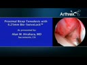 Arthrex - Proximal Biceps Tenodesis with 6.25 mm Bio-SwiveLock™