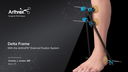 Arthrex - Delta Frame With the ArthroFX® External Fixation System