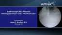 Arthrex - Arthroscopic SLAP Repair Utilizing LabralTape™ and 2.9 mm ...