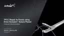 Arthrex - TFCC Repair to Fovea Using Knee Scorpion™ Suture Passer