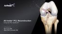 Arthrex - All-Inside PCL Reconstruction: Using the PCL GraftLink®